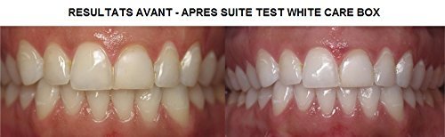 Whitecare – Test et avis | Le Meilleur Avis